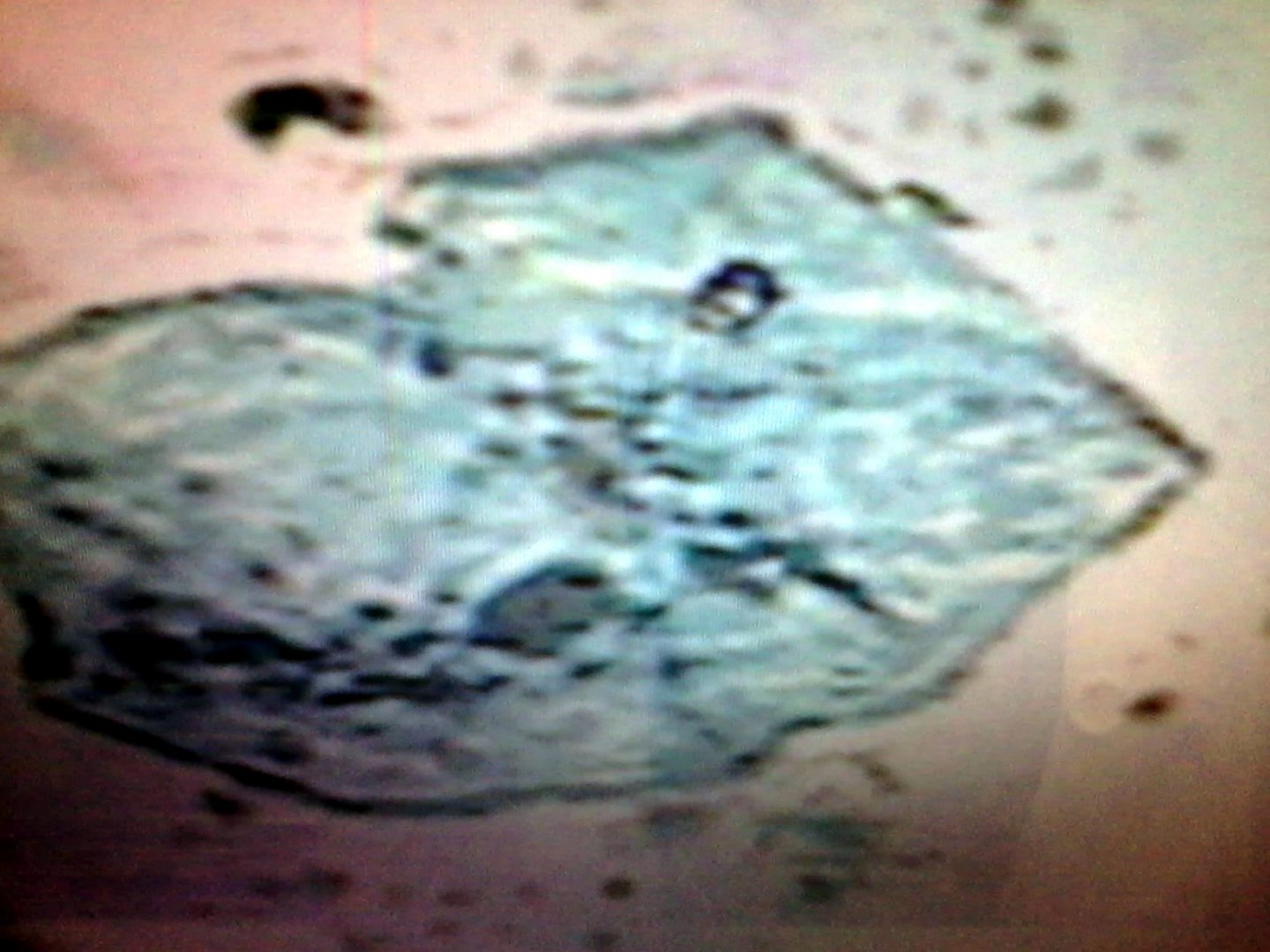 Células del epitelio bucal Imagen & Foto | naturaleza diversa , células ...