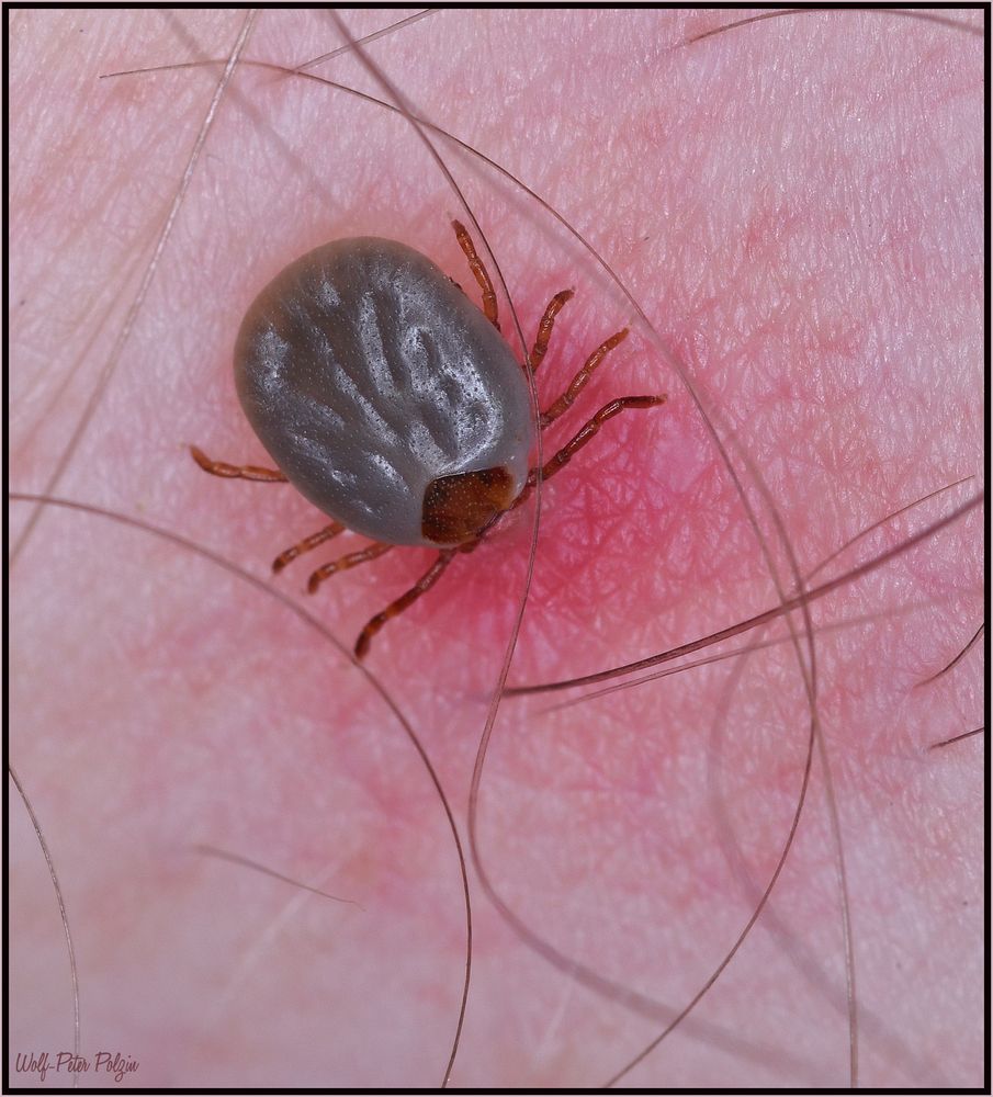 Festgebissen: Zecke in der Haut (Costa Rica) Foto & Bild | tiere ...