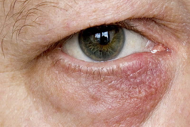 gerstenkorn Foto & Bild | fotos von teilen des gesichts, körperdetails ...