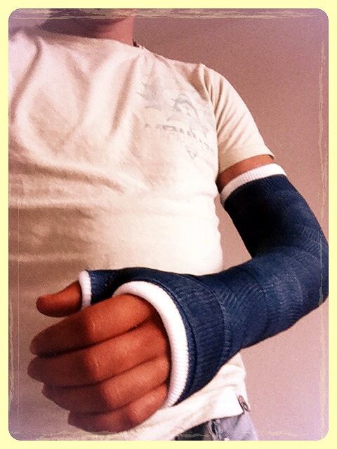 Gip(t)s dass? Foto & Bild | körperdetails, gips, gipsarm Bilder auf ...