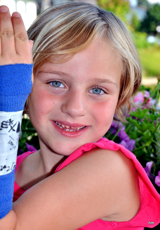 Isabelle Manon mit dem Gipsarm -2- Foto & Bild | kinder, kinder im ...