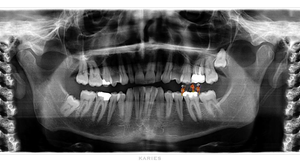Karies Foto & Bild | panorama, techniken, aufnahme-techniken Bilder auf ...