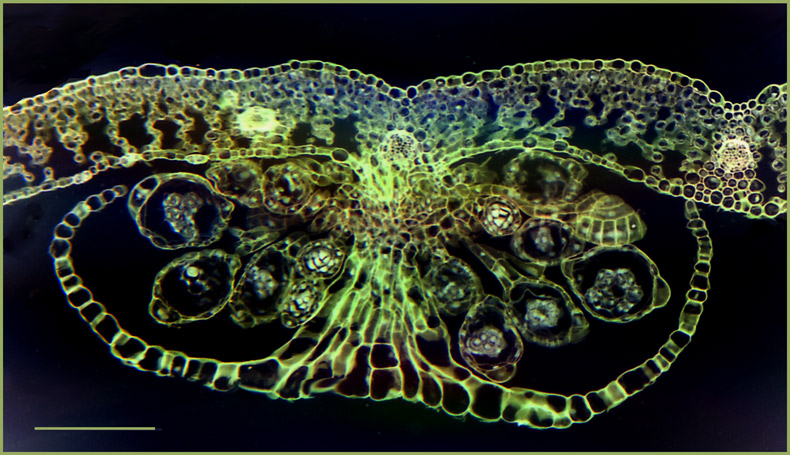 Sorus Foto & Bild | natur-kreativ, aufnahmetechniken, mikroskop ...