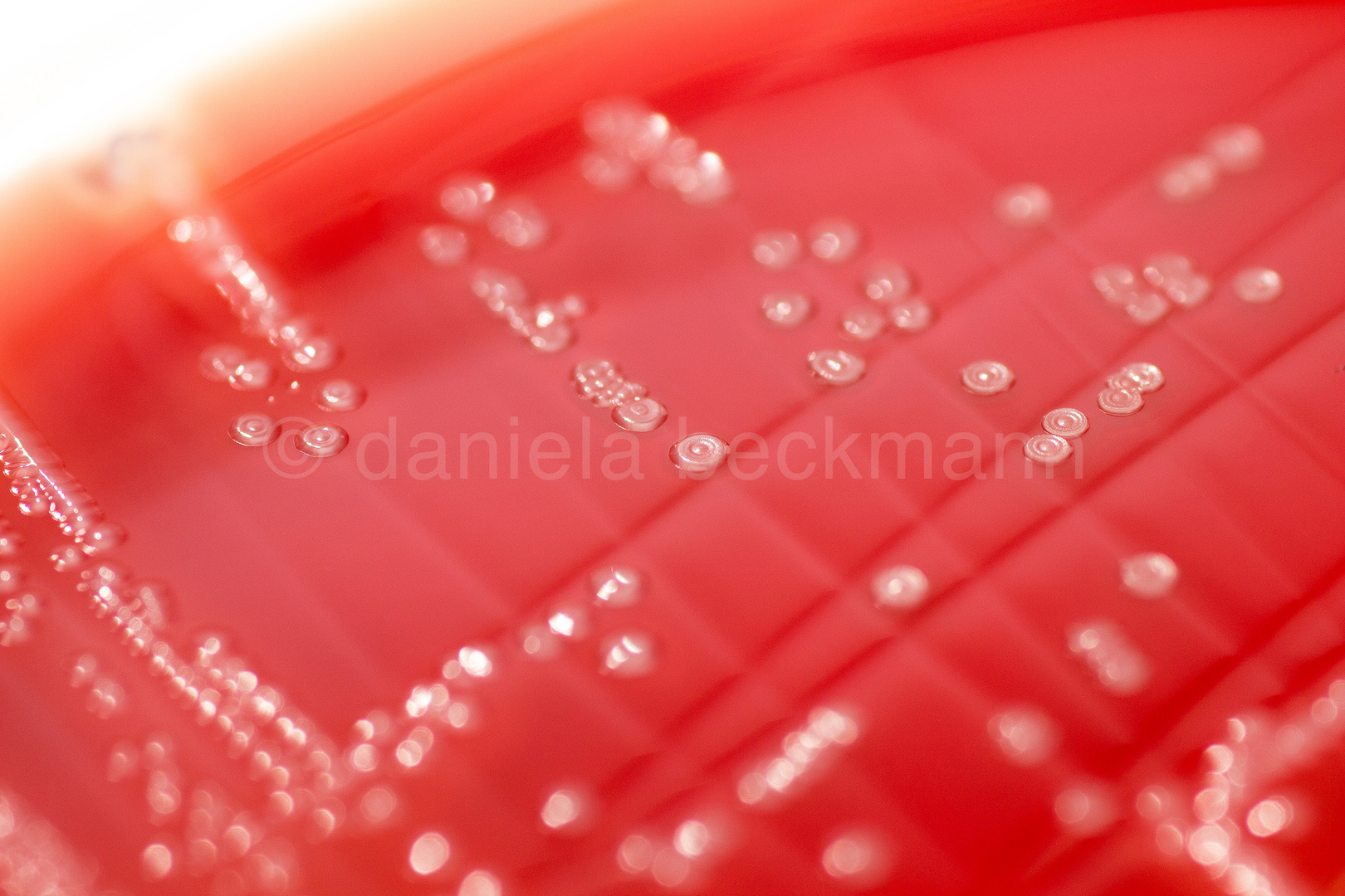 Streptococcus pyogenes Foto & Bild | spezial, blut, blood Bilder auf ...