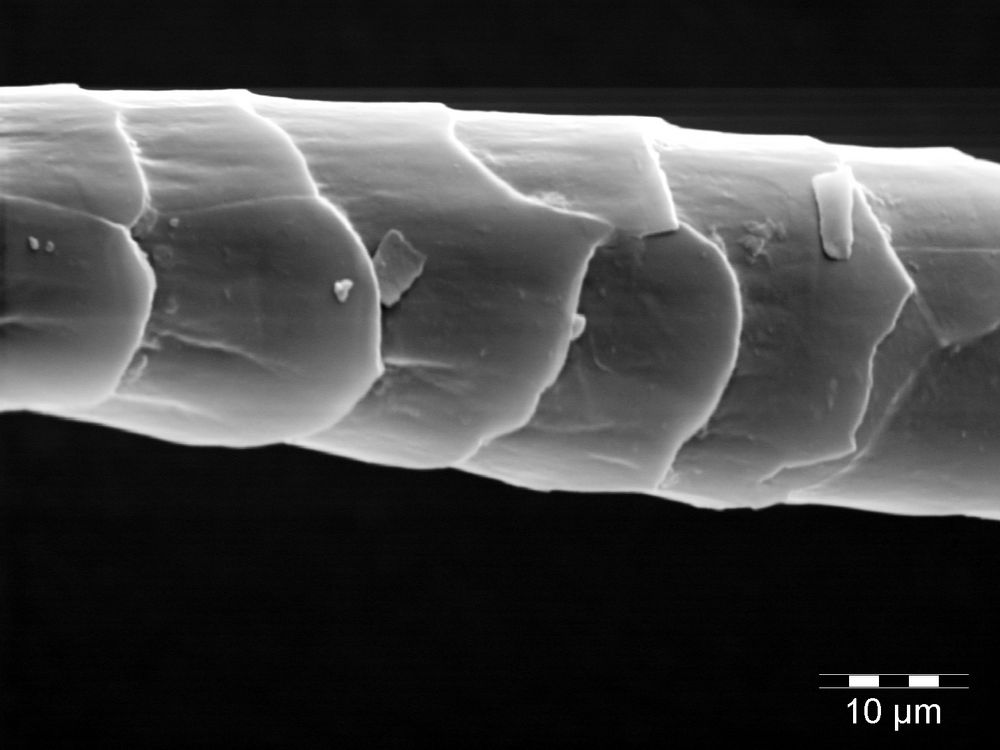 Wolle (unbehandelt) - Rasterelektronenmikroskop (REM) Foto & Bild ...